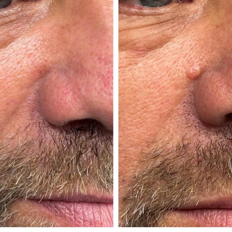 Dermatologist | Troy, MO | St. Louis Dermatology & Cosmetic Surgery