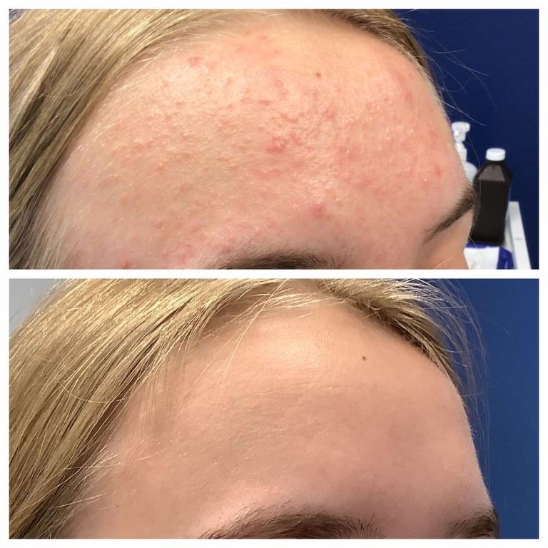 Dermatologist | Troy, MO | St. Louis Dermatology & Cosmetic Surgery